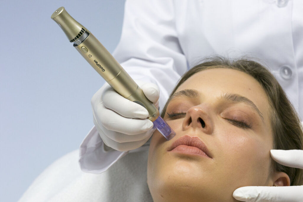 Basistraining Microneedling | SURE Medical